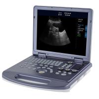 China Medical Ultrasound Machine SuppliersB&W Ultrasound 15.6-inch LCD medical monitor with high resolution and 180-degree open angle for sale