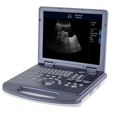 China Medical Ultrasound Machine SuppliersB&W Ultrasound 15.6-inch LCD medical monitor with high resolution and 180-degree open angle for sale