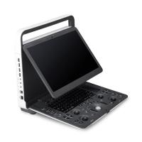 China Sonoscape E2 Color Doppler Cardiac Diagnostic System Price, Echo Transductor Portable Ultrasound Machine for sale
