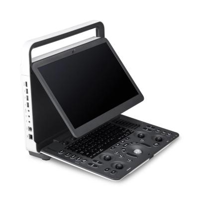 China Sonoscape E2 Color Doppler Cardiac Diagnostic System Price, Echo Transductor Portable Ultrasound Machine for sale