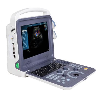 China Best Price Human or Veterinary Portable Colour Doppler Ultrasound Machine for OB & GYN for sale