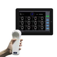 China Medical Ultrasound Diagnostic Equipment 4D Wireless Portable Mini Ultrasound Bladder Probe for sale