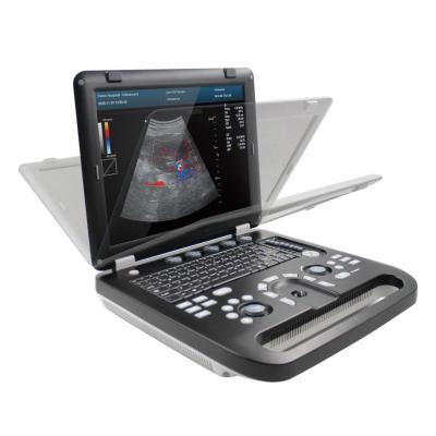 China High Quality Ultrasound Scanner 3D 4D 5D Portable Color Doppler Ultrasonic Diagnostic System for sale
