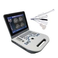 China Black and White Ultrasound Diagnostic Equipment Fibroscan Portable Full Digital Ultra sound Scanner for sale