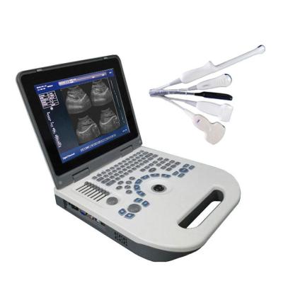 China Black and White Ultrasound Diagnostic Equipment Fibroscan Portable Full Digital Ultra sound Scanner for sale