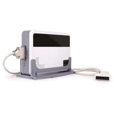 China CE ISO Approved Medical Diagnostic Equipment Portable Ultrasound Bone Scan Densitometer Machine DEXA for sale
