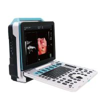 China Portable Ultrasound Pregnancy Monitoring Devices 15 Inches High Definition for sale