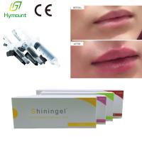 China Biological Fermentation 2ml Dermal Filler Hyaluronic Acid Smooth Out Lines for sale