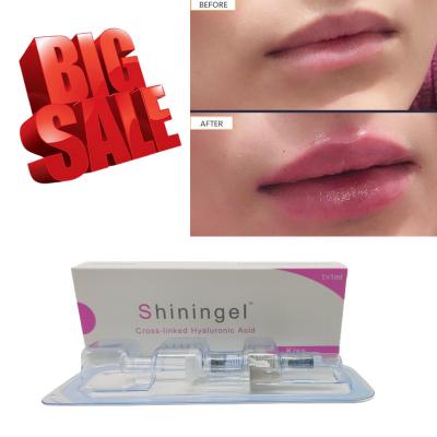 China 50ml Skin Sodium Hyaluronate Gel Injection For Under Eye Bags for sale