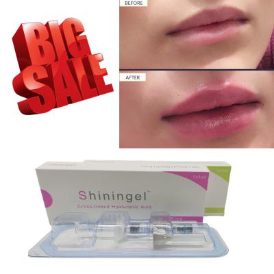 China EDQM Instant Deep Hyaluronic Acid Wrinkle Fillers For Under Eye for sale
