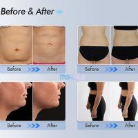 China Home 80kpa Fat Freeze Cavitation Machine 360 Cryoskin Slimming Machine for sale