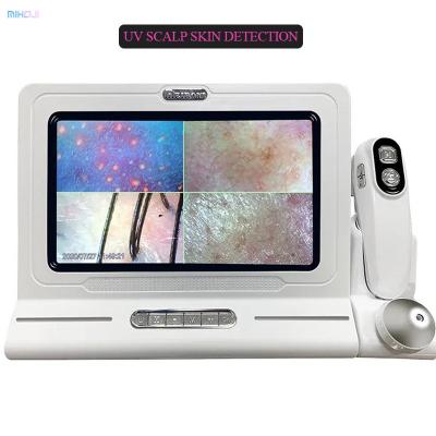 China Portable Scalp Hair Scanner for White Hair Follicle Analysis and Pigmentation Testing for sale