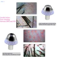 China Portable Scalp Hair Scanner for White Hair Follicle Analysis and Pigmentation Testing for sale