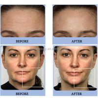 China UK Plugs Face Muscle Stimulator Machine STANDING For Skin Tightening for sale