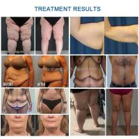 China 40K Cavitation 360 Cryolipolysis Machine 7 In 1 For Body Slimming Beauty Device for sale