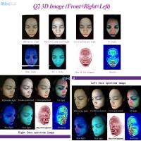 China Portable Skin Analyzer Facial Machine with 36 Million Pixels Facial Analysis Touch Screen for sale