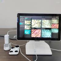 China Desktop Hair Scalp Detector Professional With Dual System And Smart Switching for sale
