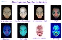 China Touch Screen Skin Analysis Device 3D For Wrinkle And Pigmentation Detection for sale