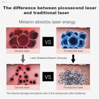 China Portable Picosecond Laser Machine High Efficiency For Tattoo Removal for sale
