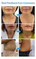 China 2023 Hot selling 7D Facial Lifting Anti-Wrinkle Beauty Salon Equipment for sale