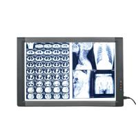 China 21 Inch Medical Film Viewer with 30W LED Display, 1920×1080 Resolution and DICOM Compatibility for Diagnostic Imaging for sale