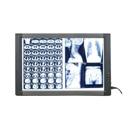 China 21 Inch Medical Film Viewer with 30W LED Display, 1920×1080 Resolution and DICOM Compatibility for Diagnostic Imaging for sale