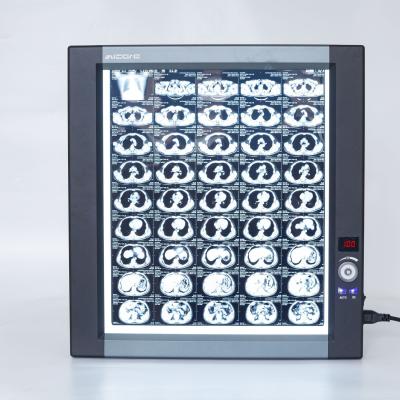 China 21 Inch Desktop LED Medical X-Ray Viewer with 1920x1080 Resolution and sRGB Color Gamut for Radiology Imaging for sale