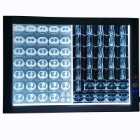 China SRGB X-Ray Light Box 21 Inch with DICOM Compatibility - 1920x1080 Resolution, 30W Power Consumption for sale