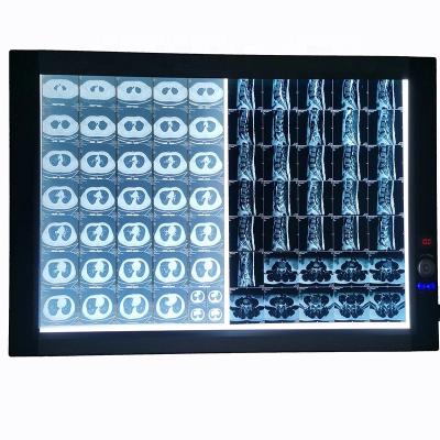 China SRGB X-Ray Light Box 21 Inch with DICOM Compatibility - 1920x1080 Resolution, 30W Power Consumption for sale