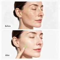China Spicule Face Essence Serum with Retinol Anti Aging Pigmentation Correction & Even Tone for sale