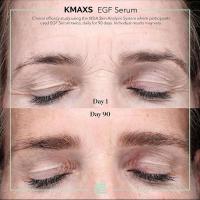 China Anti Aging Private Label Serum EGF Skin Products Set Hydrating Firming Eye Roller for sale