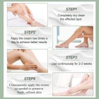 China 60 Urea Cream With Aloe Vera Tea Tree Vitamin E For Rough Cracked Skin All Skin Type Body Care for sale