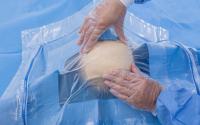 China Medical Sterile Craniotomy Drape Surgical With Aperture 1pc / Pouch for sale