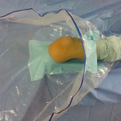 China Medical Disposable Surgical Knee Arthroscopy Drape Pack / Kit for sale