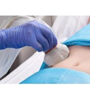 China High Infection Control Sterile Surgical Drapes Style Style Standard for sale