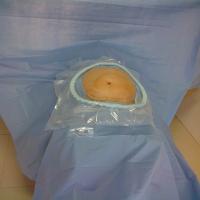 China High Absorbency Disposable Surgical Packs with Reinforced Absorbent Critical Zones and EO Sterilization for Hospital Emergency for sale