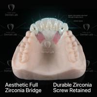 China CAD CAM Digital Dental Lab Screw Retained Bridge Customizable for sale