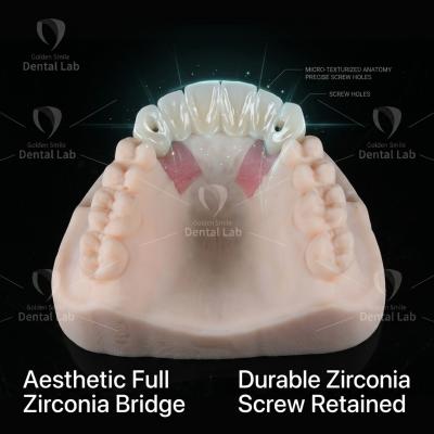 China CAD CAM Digital Dental Lab Screw Retained Bridge Customizable for sale