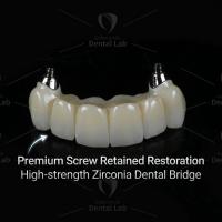 China CAD CAM Digital Dental Lab Screw Retained Bridge Customizable for sale