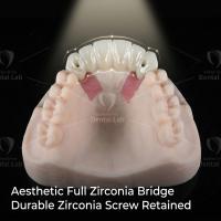 China Custom Made Dental Lab Products Professional Full Zirconia Screw Retained Bridge for sale