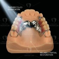 China Acrylic Printed Partial Framework Design China Dental Lab Comfort for sale