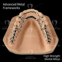 China Printed Metal Framework Dental Crown Lab Co-Cr Metal Framework Partial for sale