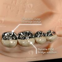 China CE FDA Chinese Dental Laboratory Dental PFM Bridge High Load Resistance for sale