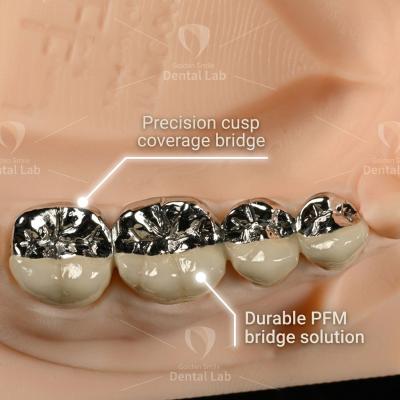 China CE FDA Chinese Dental Laboratory Dental PFM Bridge High Load Resistance for sale