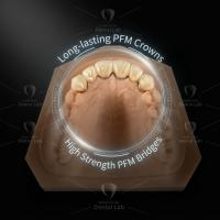 China ISO China Dental Laboratory High Strength PMF Bridge Corrosion Resistance for sale