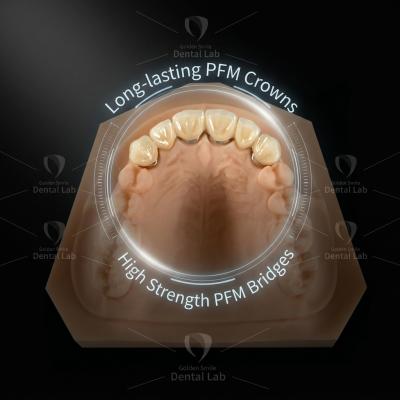 China ISO China Dental Laboratory High Strength PMF Bridge Corrosion Resistance for sale