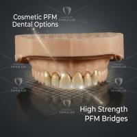 China CDT MDT Digital Design Dental Lab Co-Cr PFM Bridge Chinese Dental Laboratory for sale