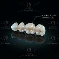 China 3D Printing Dental Lab Shenzhen Durable Aesthetic Zirconia FDA Approval for sale