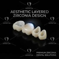 China 3D Printing Dental Lab Shenzhen Durable Aesthetic Zirconia FDA Approval for sale