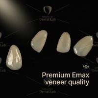 China Translucency Emax Lithium Disilicate Veneers Ceramic Layered Emax Veneers for sale